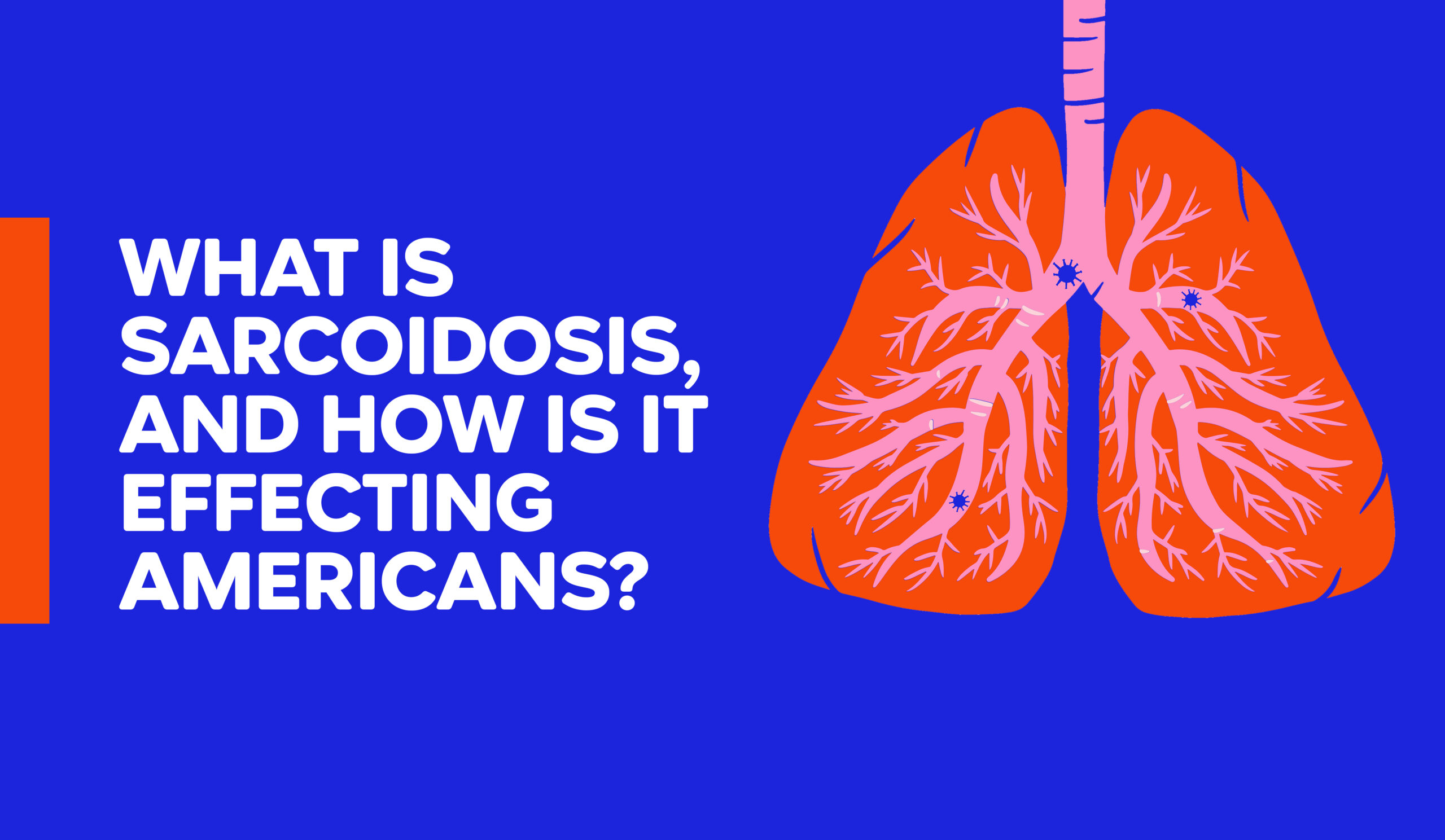 What is Sarcoidosis and how does it effect Americans? - Direct Primary ...